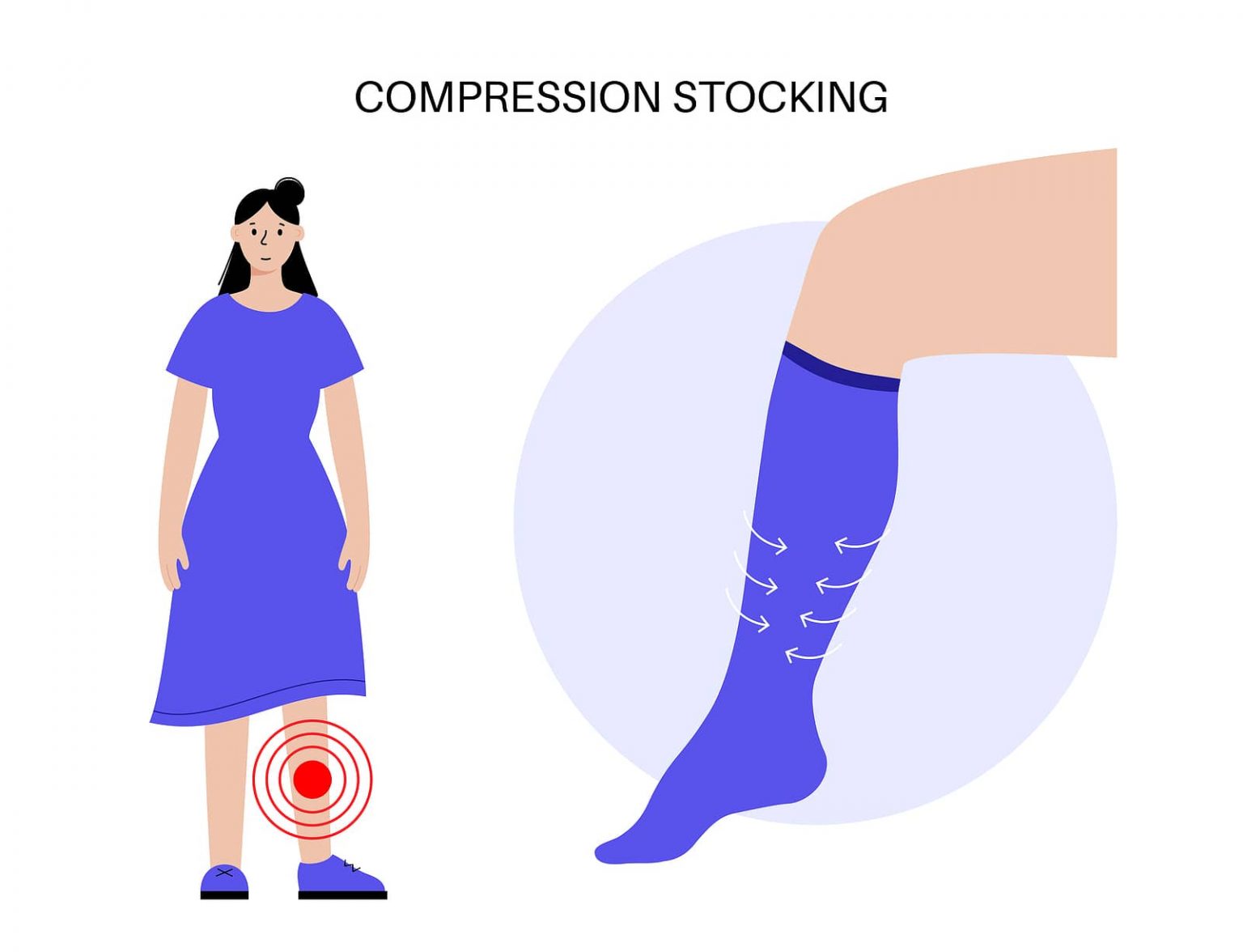 Medicare Coverage for Compression Socks | Medigap.com